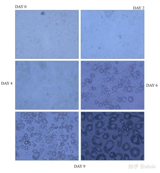 3T3-L1细胞培养及经典“鸡尾酒”诱导攻略 - 知乎