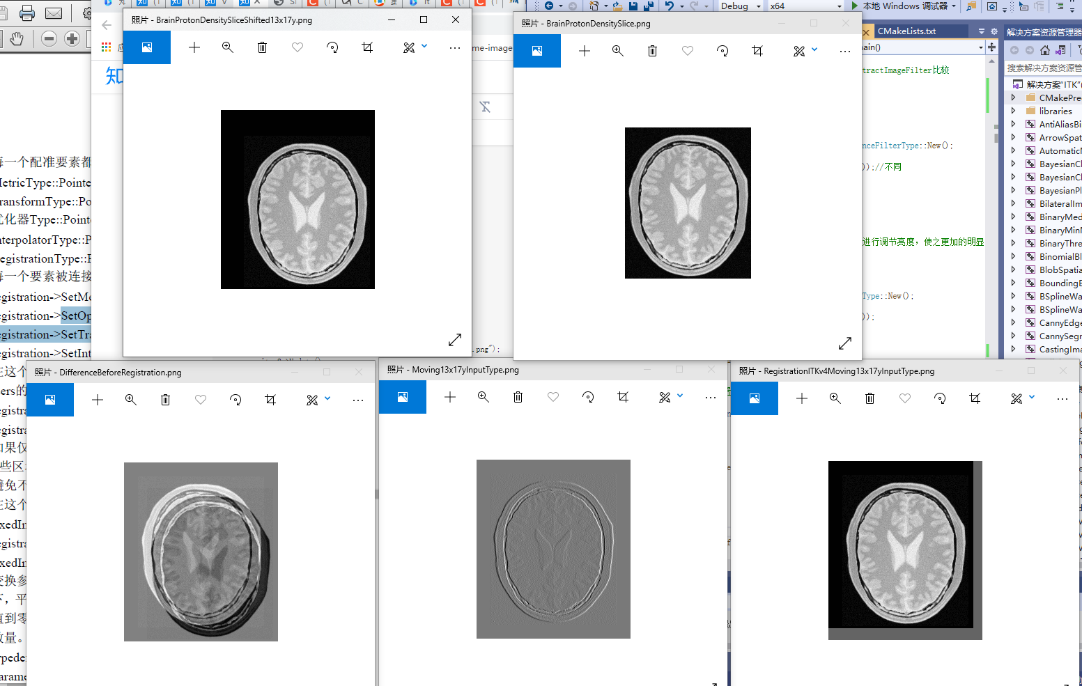 ITK_医学图像配准 - 知乎