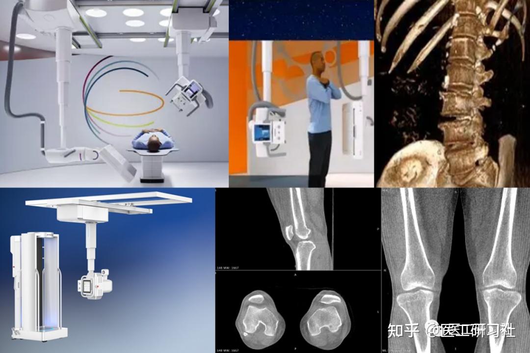 CBCT：不是CT，但也前途一片光明 - 知乎