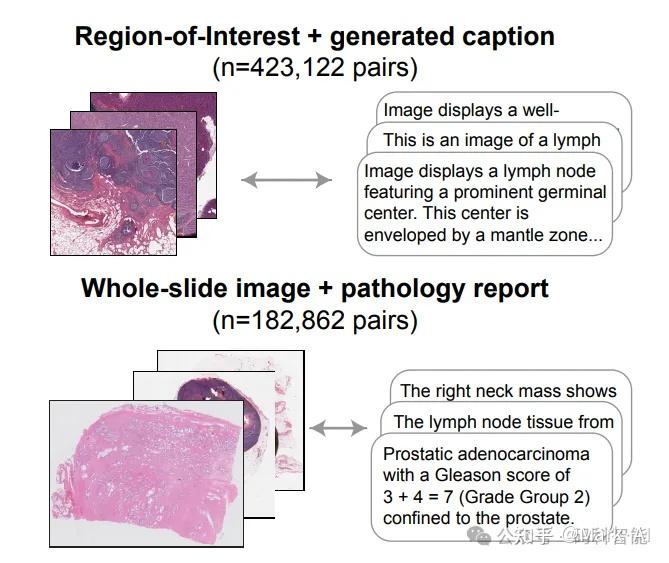 病理大模型四重奏，哈佛医学院全部开源！从UNI、CHIEF到TITAN，从诊断疾病到生成报告，适用30+癌症类型 - 知乎