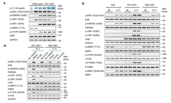 Cell新子刊丨WB含量100%丨IL-11新作用 - 知乎