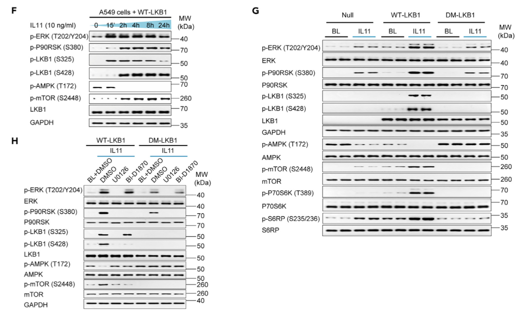 Cell新子刊丨WB含量100%丨IL-11新作用 - 知乎