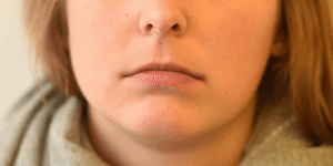 FACS-Facial Action Coding System 面部表情编码系统 各AU(Action Unit)说明 - 知乎