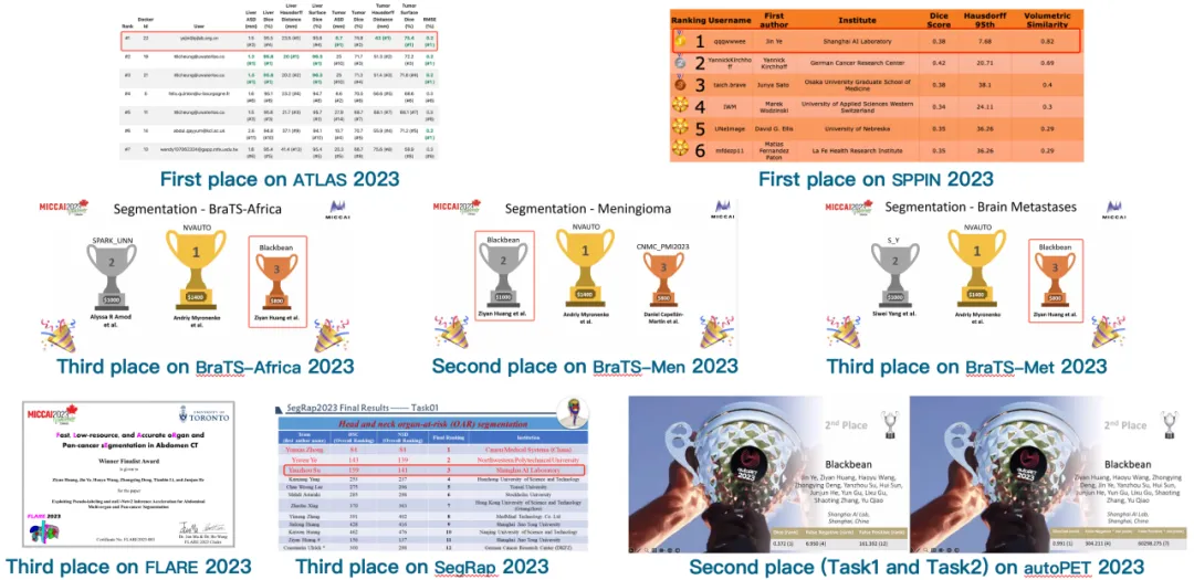 冠军方案大公开！MICCAI 2023 3D图像分割挑战赛 直播回放&问答文字版 - 知乎