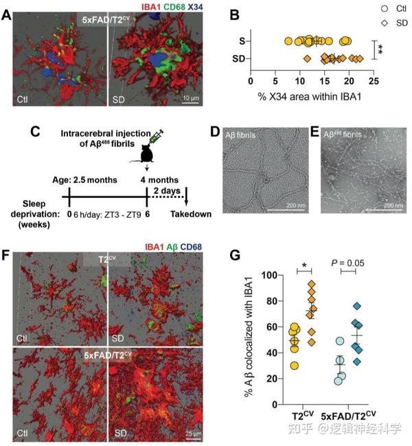 STM︱华盛顿大学科研团队发现睡眠不足促进小胶质活化和Aβ沉积依赖于TREM2 - 知乎