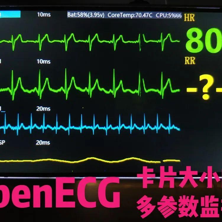 又有神作诞生！“国民技术N32 MCU杯”第七届立创电子设计开源大赛评审结果出炉 - 知乎