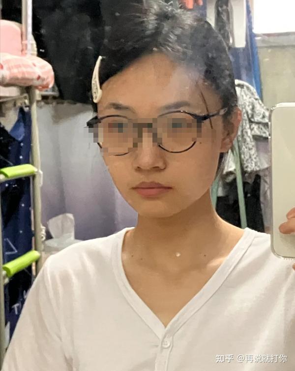 皮肤太黄了,有没有什么比较好的美白方法,或者效果好一点的美白精华? 知乎