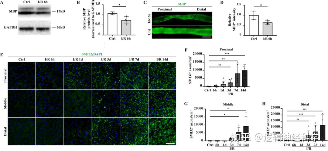Brain Pathol︱中大卓业鸿团队发现抑制S1PR2可通过缓解脱髓鞘改善视网膜缺血再灌注模型中视神经轴突损伤和视功能障碍 - 知乎