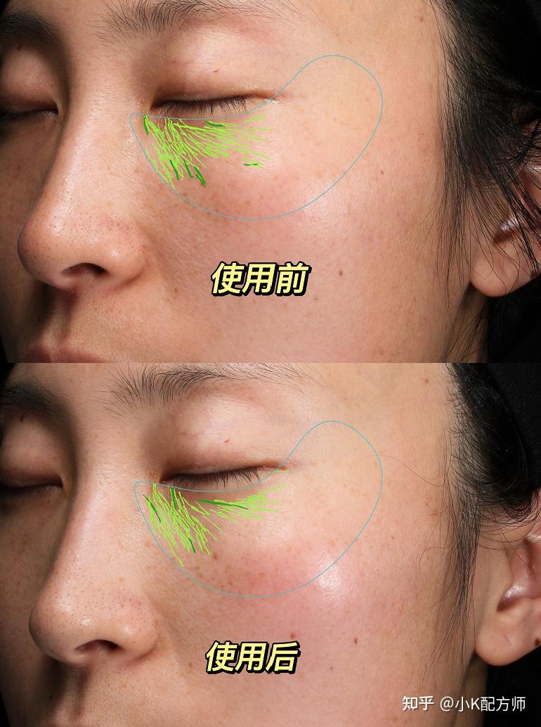 这款咖啡因眼霜改善黑眼圈、眼纹真的香！28天打卡实测告诉你！