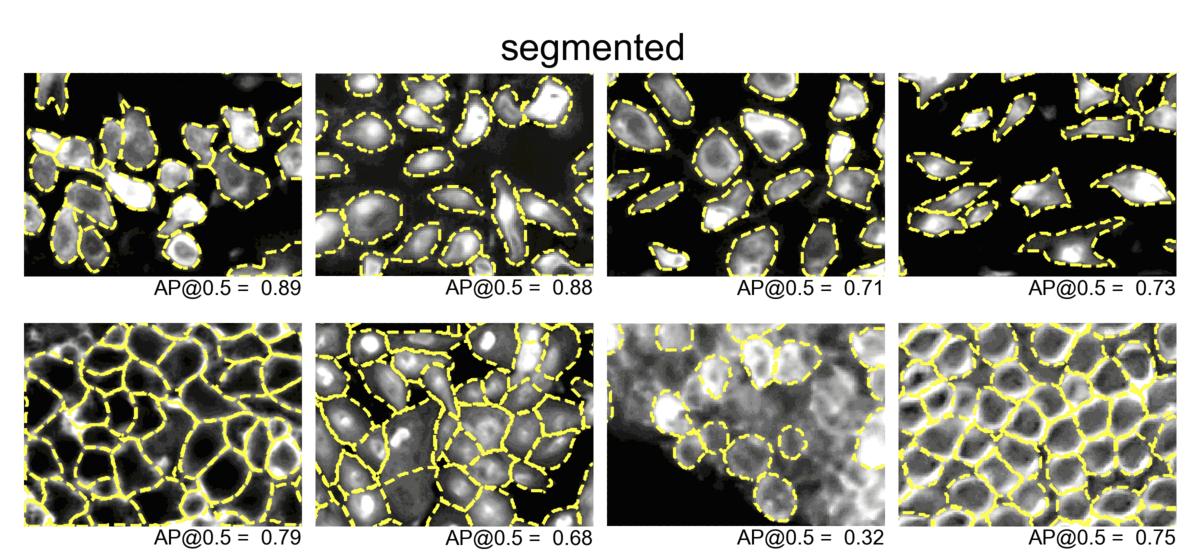 ISS空间转录组的细胞分割算法汇总(stardist、cellpose、QuPath、SCS) - 知乎