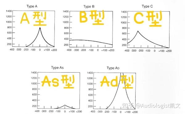 中耳疾病诊断工具之 鼓室图” 知乎