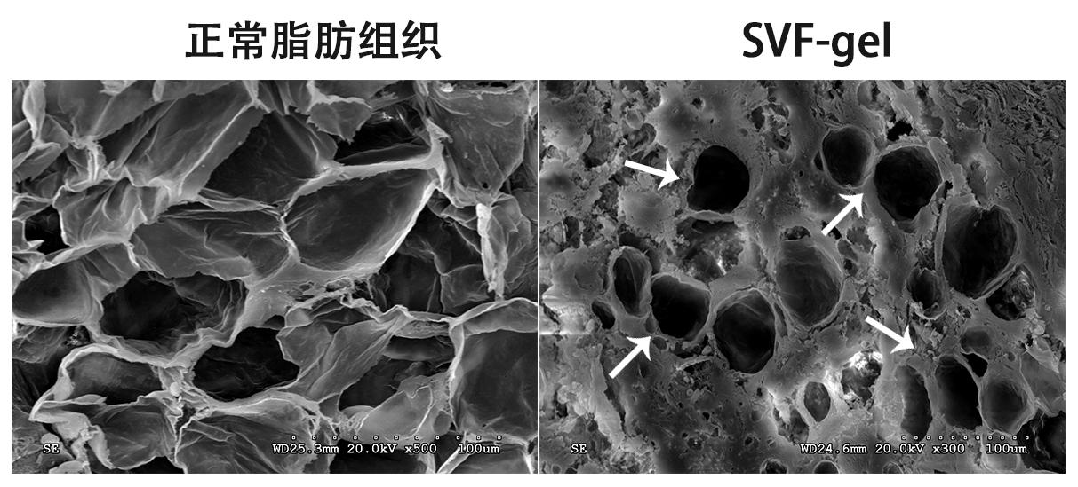 脂肪干细胞胶SVF-gel与面部年轻化 - 知乎