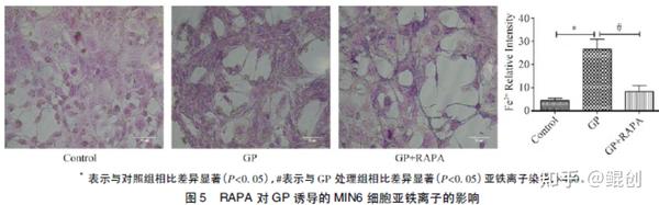 高糖高脂（葡萄糖、棕榈酸钠）诱导小鼠胰岛瘤细胞株MIN6细胞铁死亡以建立体外胰岛β细胞损伤模型 - 知乎
