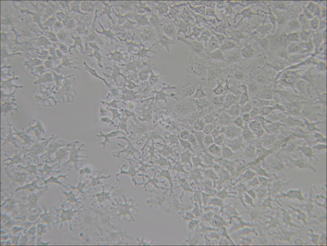 Huh-7-luc 肝癌细胞 - 知乎