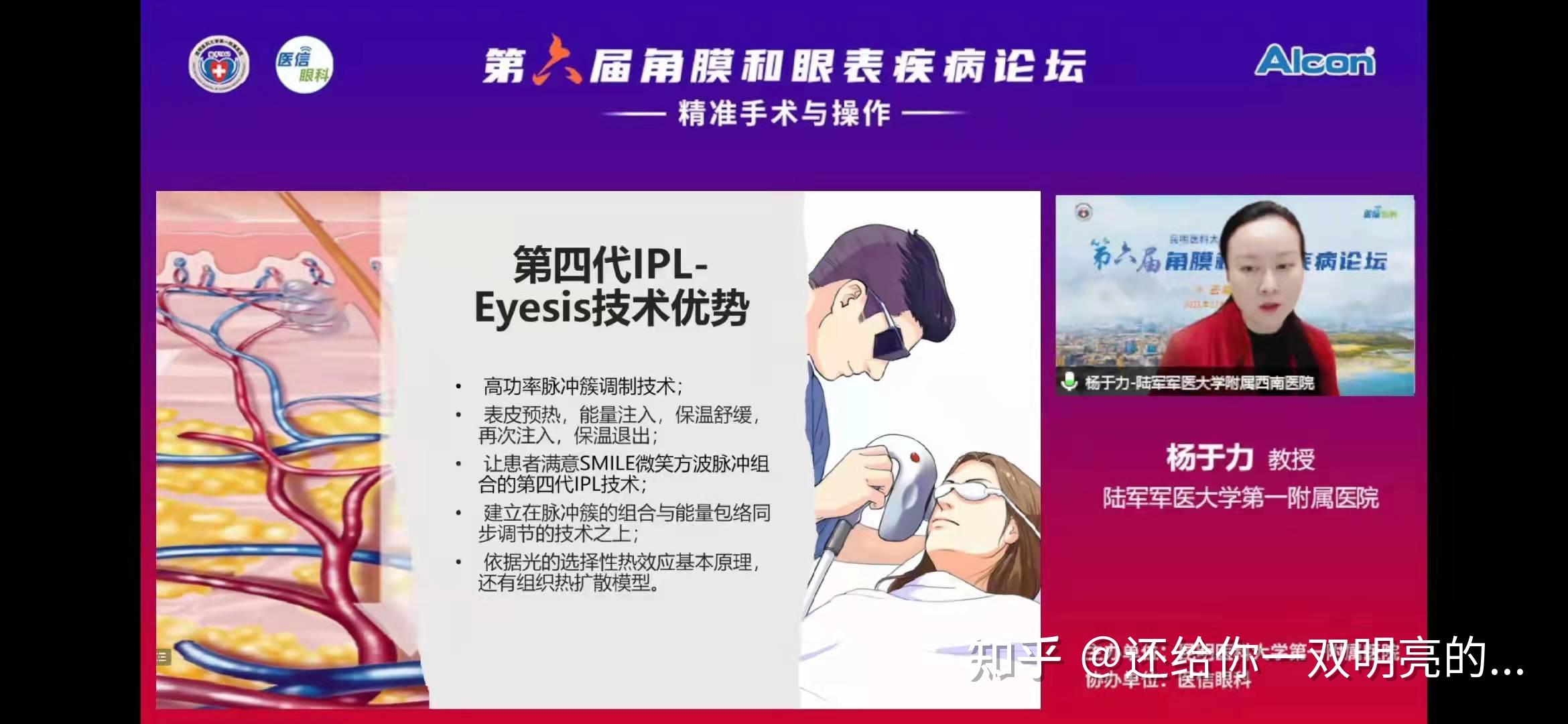 专家讲解强脉冲光（IPL）治疗干眼的临床应用 - 知乎
