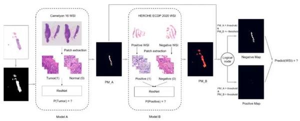 Jou Ima | AI病理挑战赛：通过HE切片图像预测乳腺癌HER2状态 - 知乎