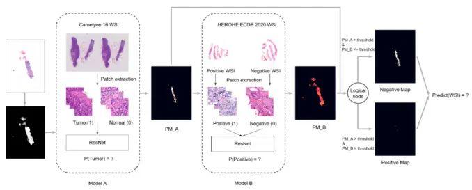 Jou Ima | AI病理挑战赛：通过HE切片图像预测乳腺癌HER2状态 - 知乎
