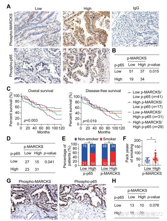 文献精读：MARCKS与NKAP联合激活烟雾相关肺癌中的 NF-kB 信号 - 知乎