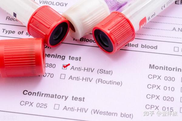 罗氏：Gazyvaro®获批用于治疗晚期滤泡性淋巴瘤 - 知乎