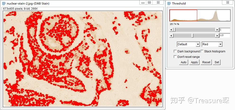 ImageJ实用技巧——免疫组化分析(定量分析篇) - 知乎