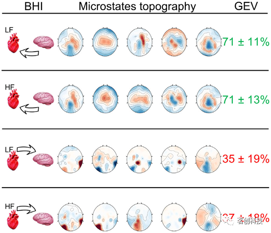 Hum Brain Mapp：皮质脑-心轴的微状态 - 知乎