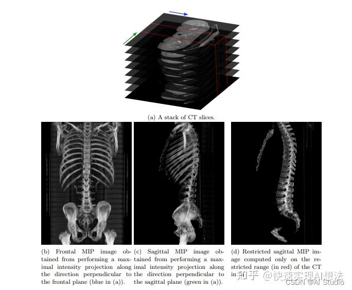 『医学影像』基于Unet模型实现脊柱CT定位（中） - 知乎