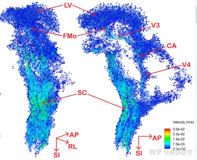 4D flow MRI概述及其研究应用 - 知乎