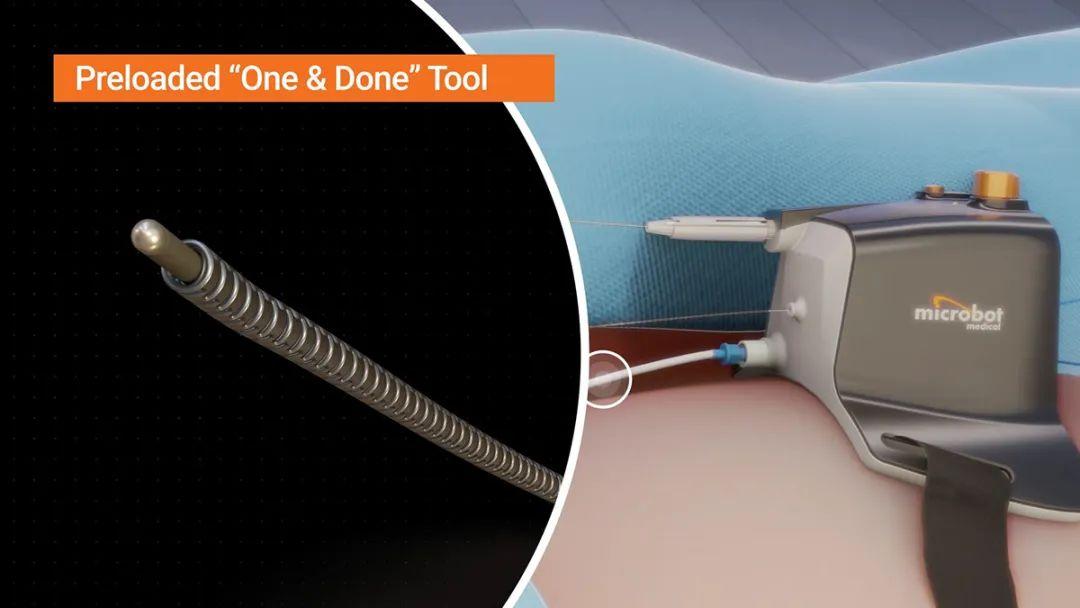 获批！血管介入机器人开展关键人体试验 - 知乎