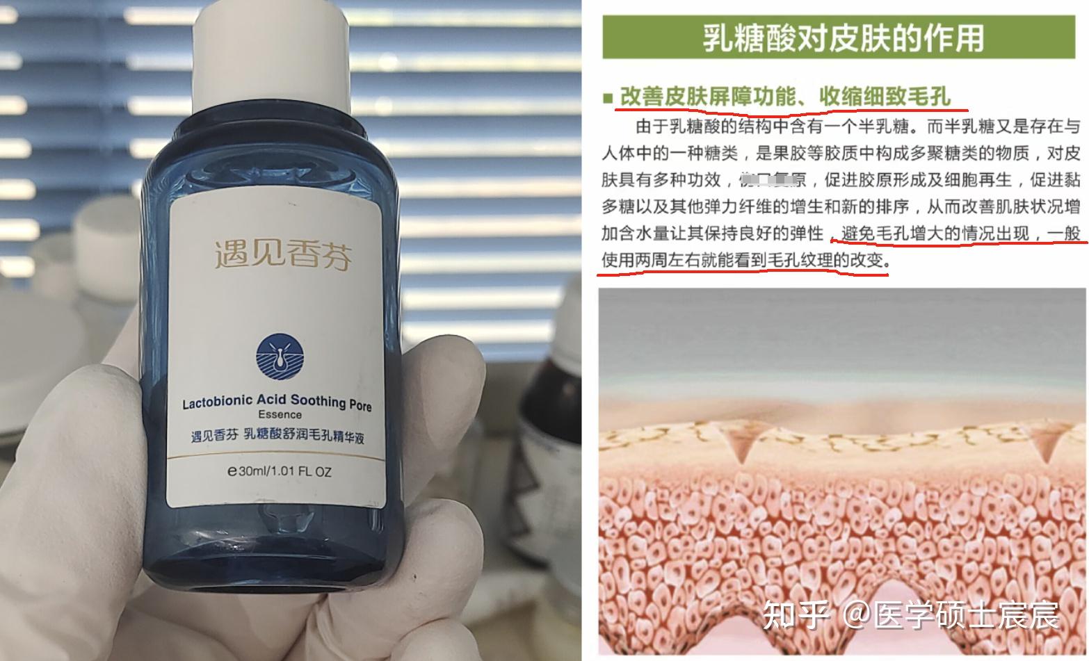 脸上白头粉刺冒个不停,挤出来一条一条的,真的没救了吗?皮肤科医生总结1000典型案例:4步解决万年白头粉刺!【28天】高效解决,皮肤光滑平整! 知乎