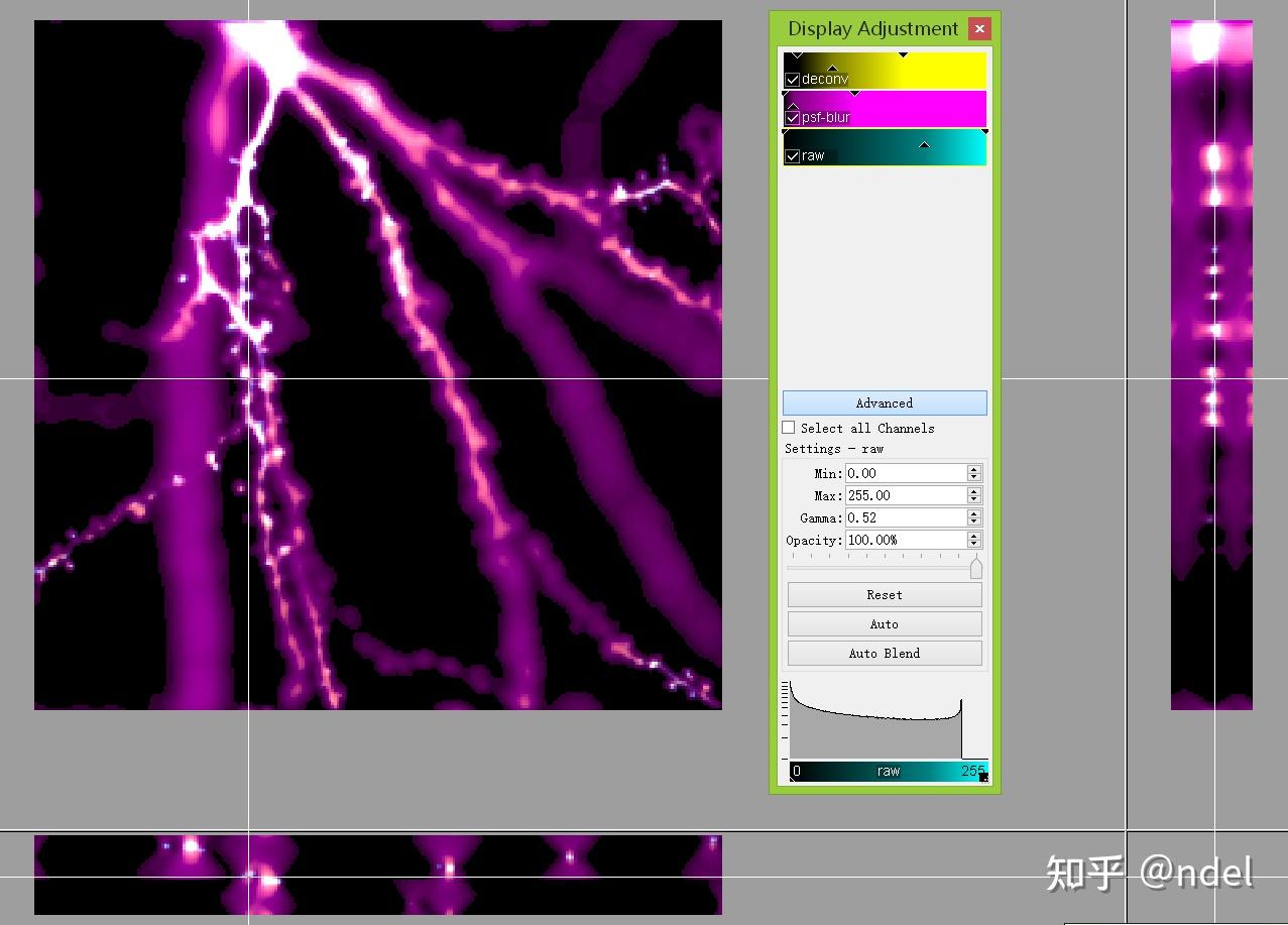 SuperColoc面向Imaris7/8添加了Deconvolution组件 - 知乎
