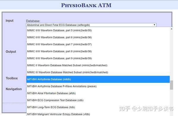 基于机器学习的心律失常分类(二)——读取MIT-BIH数据库中的心电数据[MATLAB] - 知乎