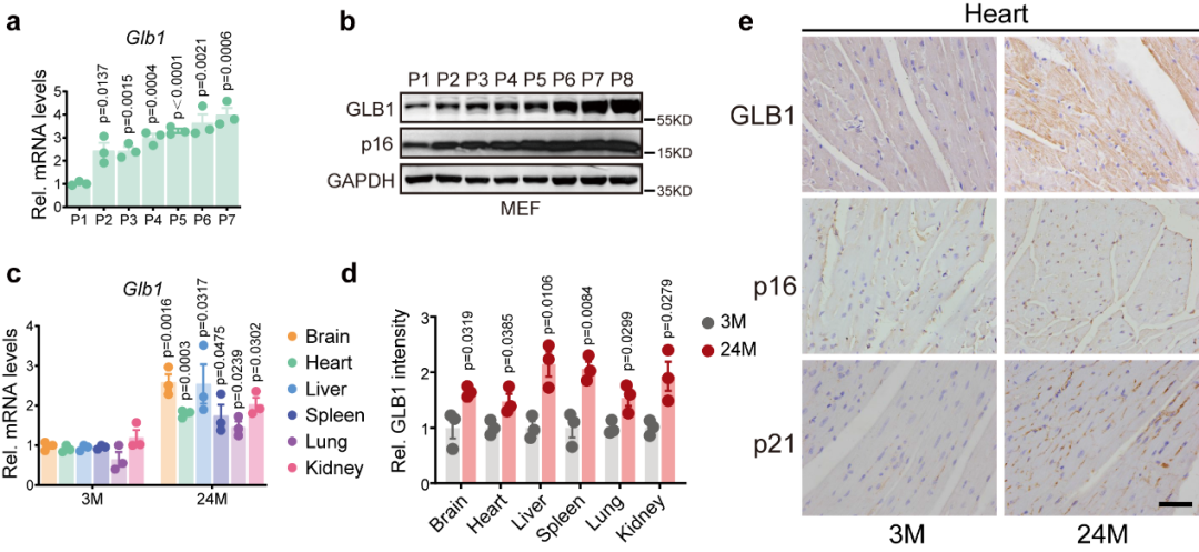 Nat Commun︱刘宝华团队创建新型可中年预测器官衰老与寿命的衰老实时监测小鼠模型 - 知乎