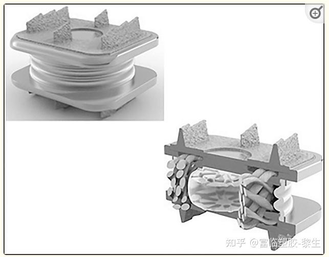 CarboSil制作腰椎和颈椎椎间盘有机硅聚碳酸酯聚氨酯共聚物 - 知乎