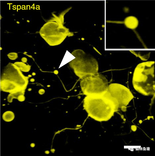 迁移体的发现及研究进展 - 知乎