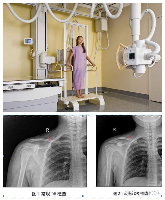 B超、DR、CT、MRI是什么东西？ - 知乎