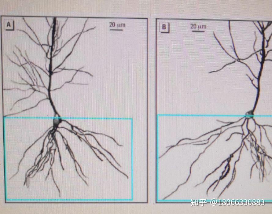 请问我这种图可以通过什么处理后用来做sholl分析吗？ - 知乎