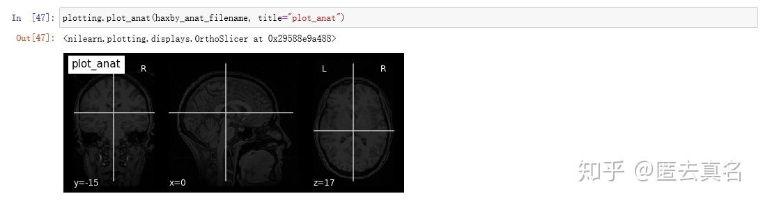 nilearn 笔记（5） - 知乎