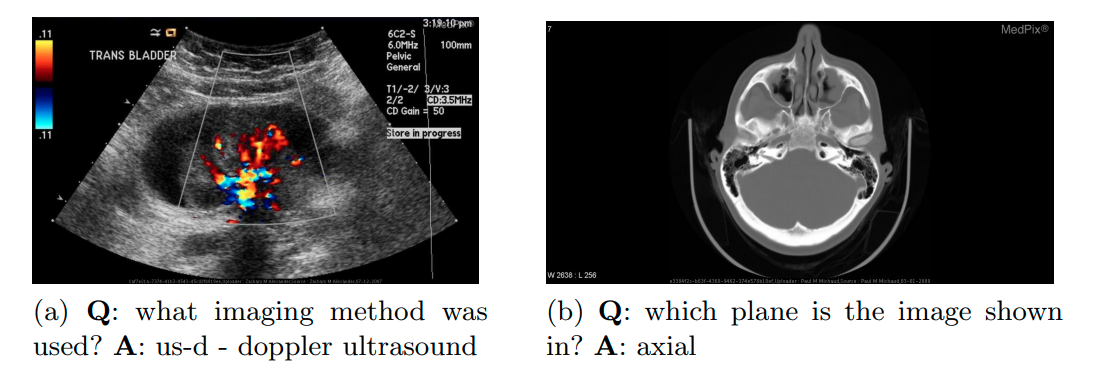 ImageClef-2019-VQA-Med 数据集介绍 - 知乎