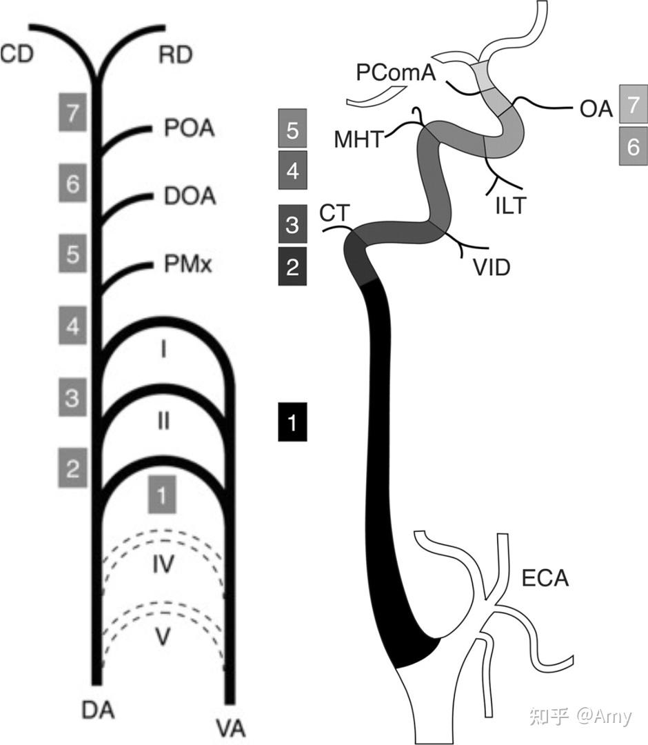 颈内动脉的8种分段系统 - 知乎