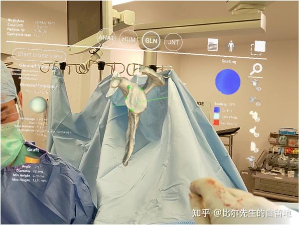 浅谈混合现实（MR）在骨科的应用（二） - 知乎