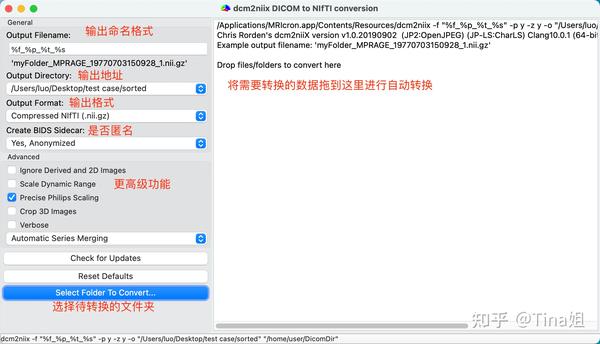 【最全】如何不写代码将 Dicom 图像转 Nifti 格式， 7种工具任你选！ - 知乎