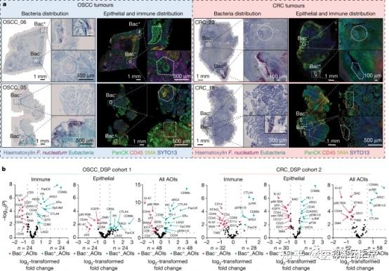 nature│肿瘤内微生物群对癌症空间和细胞异质性的影响 - 知乎