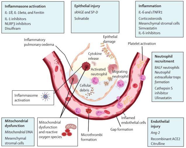 第158期 ARDS的诊断、病理生理学及治疗策略 - 知乎