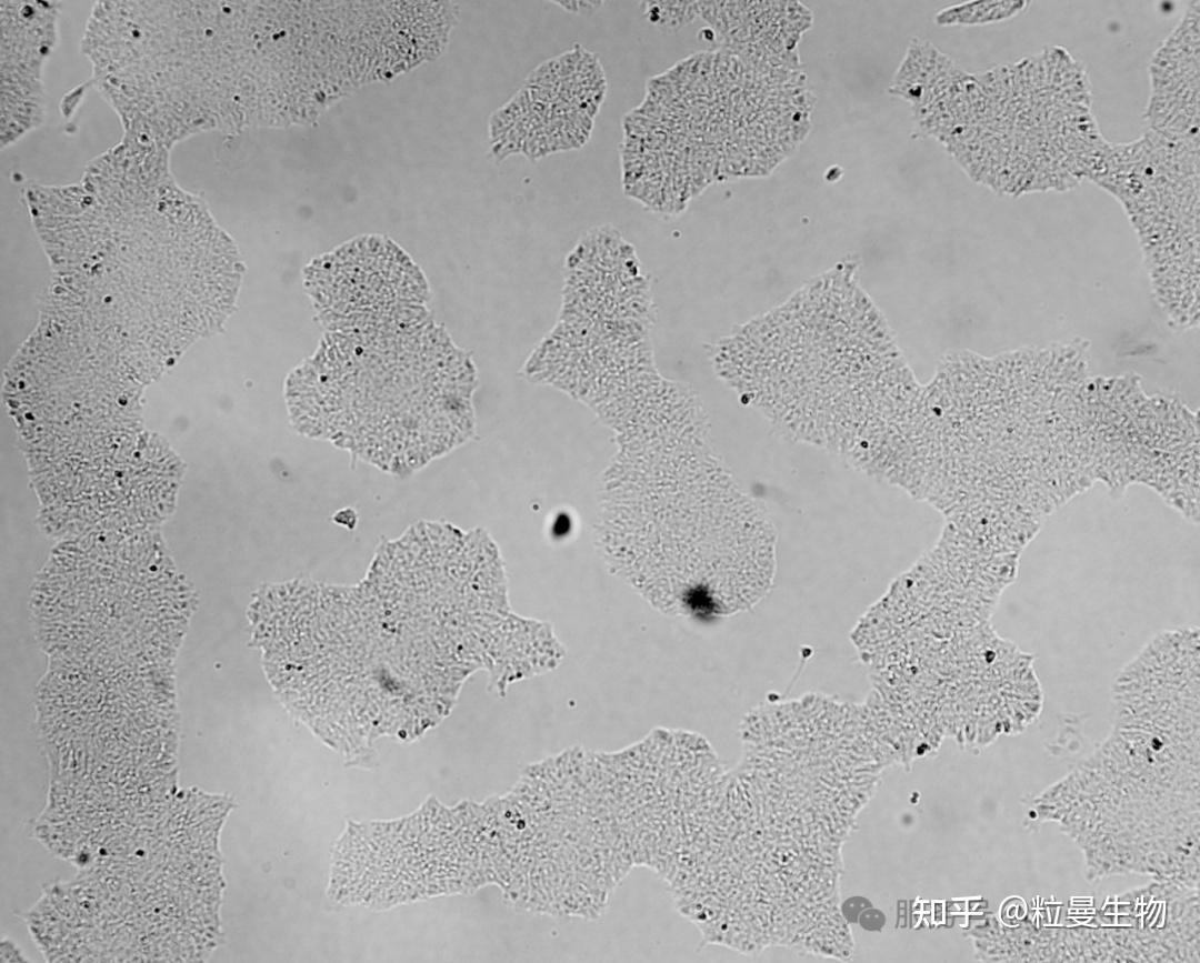 一叶知秋 | hESC（H9）基因编辑全攻略：解锁干细胞研究的无限可能 - 知乎