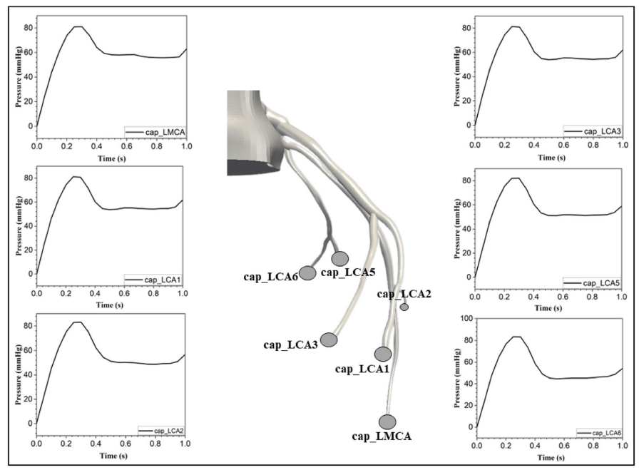 SimVascular参数计算 - 知乎