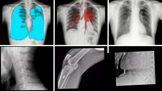 CBCT：不是CT，但也前途一片光明 - 知乎