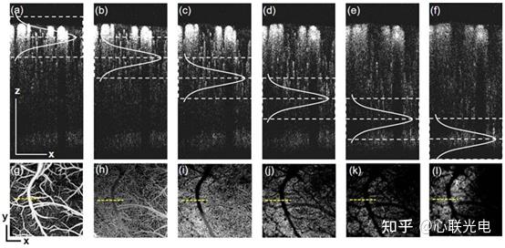 Opt. Lett.：液体变焦镜头结合OCTA进行小鼠大脑深层皮质血流成像 - 知乎