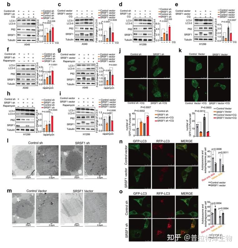 【高分SCI解读】SRSF1介导的Bcl-x可变剪接影响肺癌细胞自噬 - 知乎