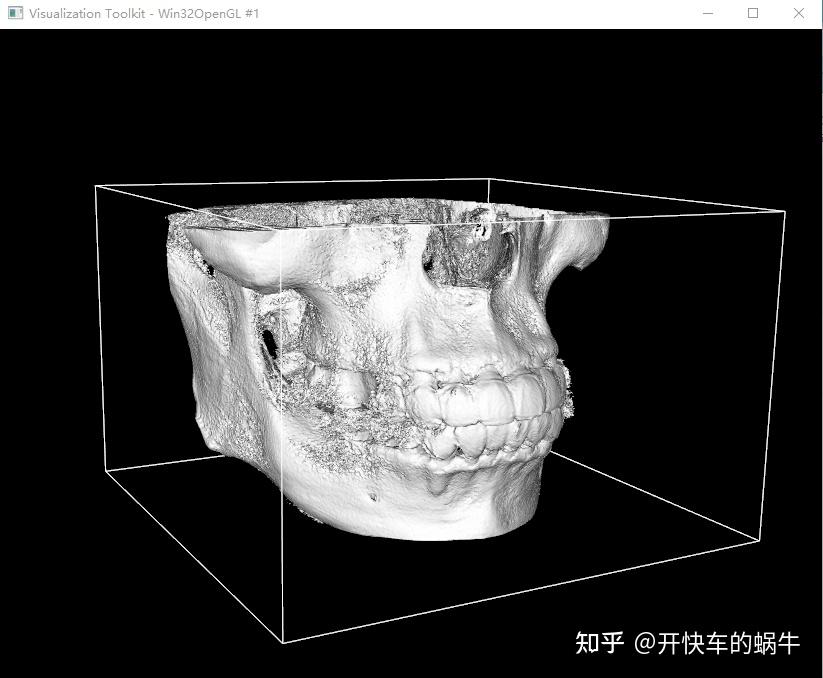 Python numpy处理dcm三维图像 - 知乎