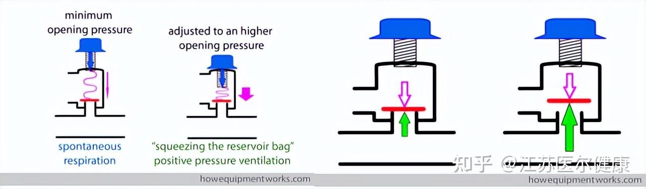APL阀的关键作用：保障麻醉通气的安全和顺利 - 知乎